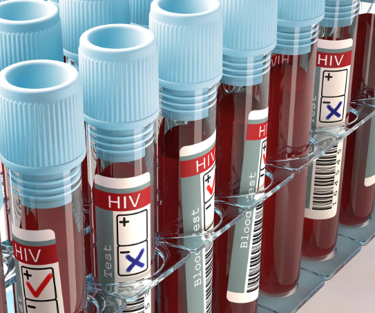 Të paktën 5 persona janë shëruar. A po merr fund pandemia e SIDA-s ...